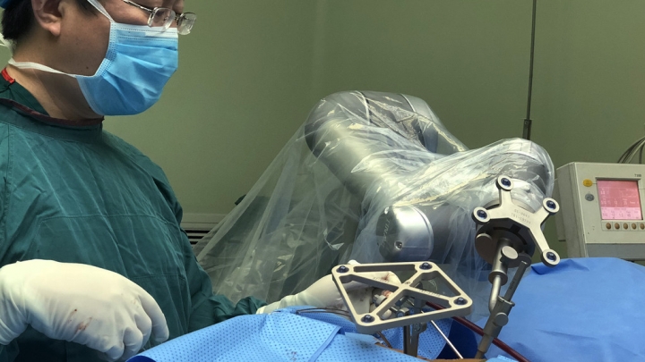 Hefei hospital uses China-developed robot to perform surgeries - China Plus